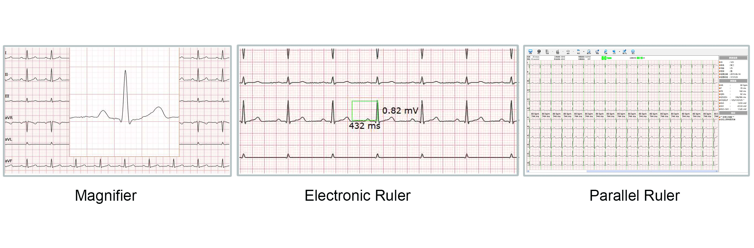 PE-1201 - PC-ECG - ECGMAC