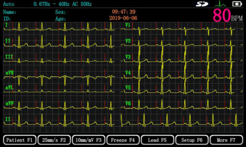 EM-1201 - Multi-Channel ECG - ECGMAC