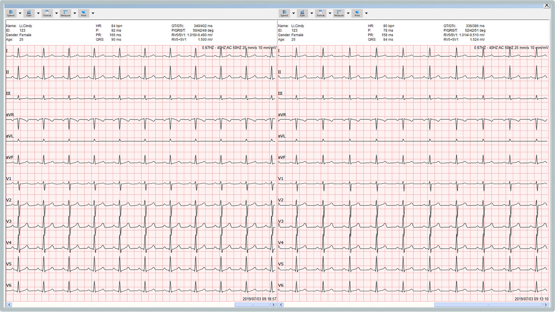 PE-1201 - PC-ECG - ECGMAC